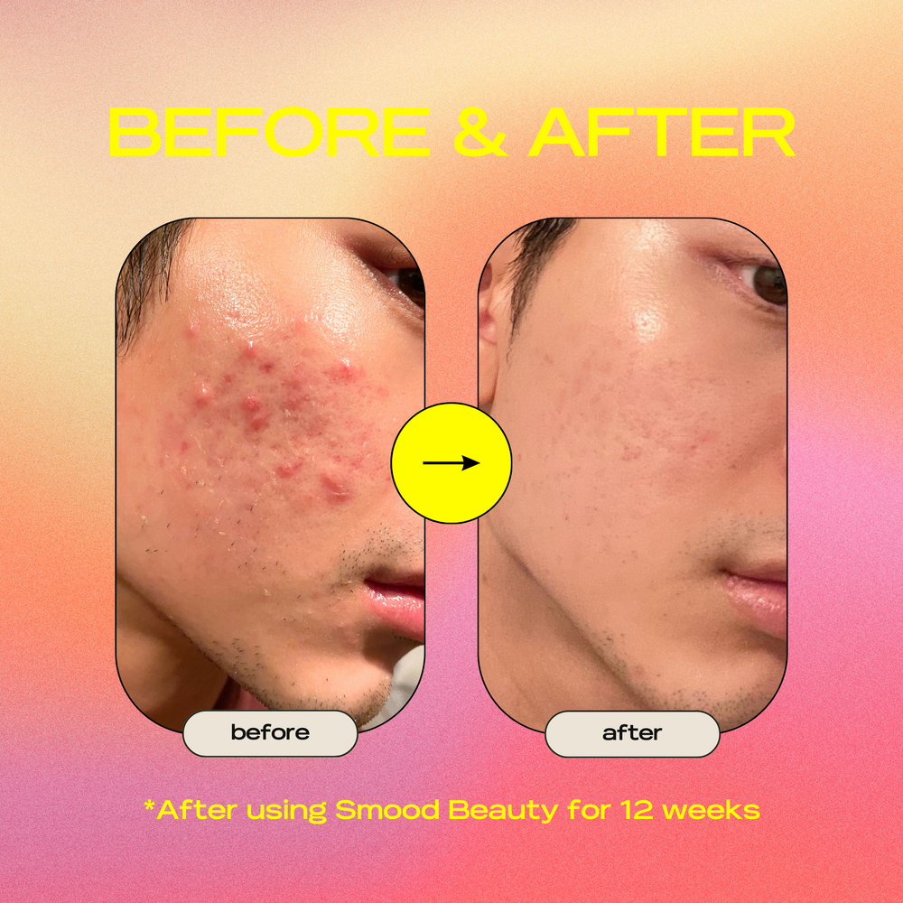 Problem Solver Gel Cream Moisturizer